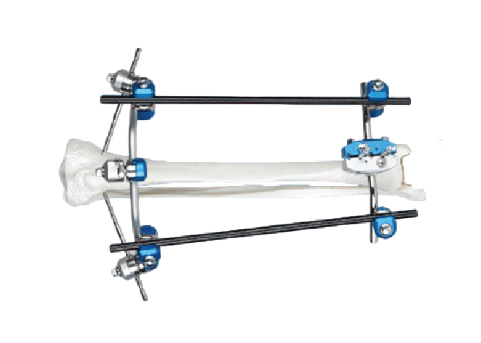 About Us | Orthcon Medical